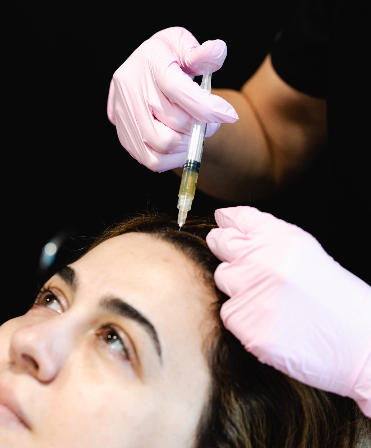 PRP Treatment Glendale | PRP Treatment Burbank | The Skin Agency